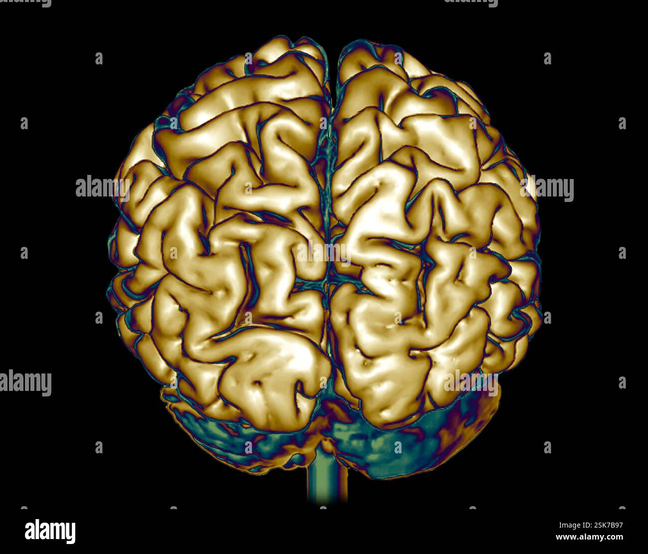 Human brain. Coloured three-dimensional (3D) Magnetic Resonance Imaging (MRI) scan in rear view ...