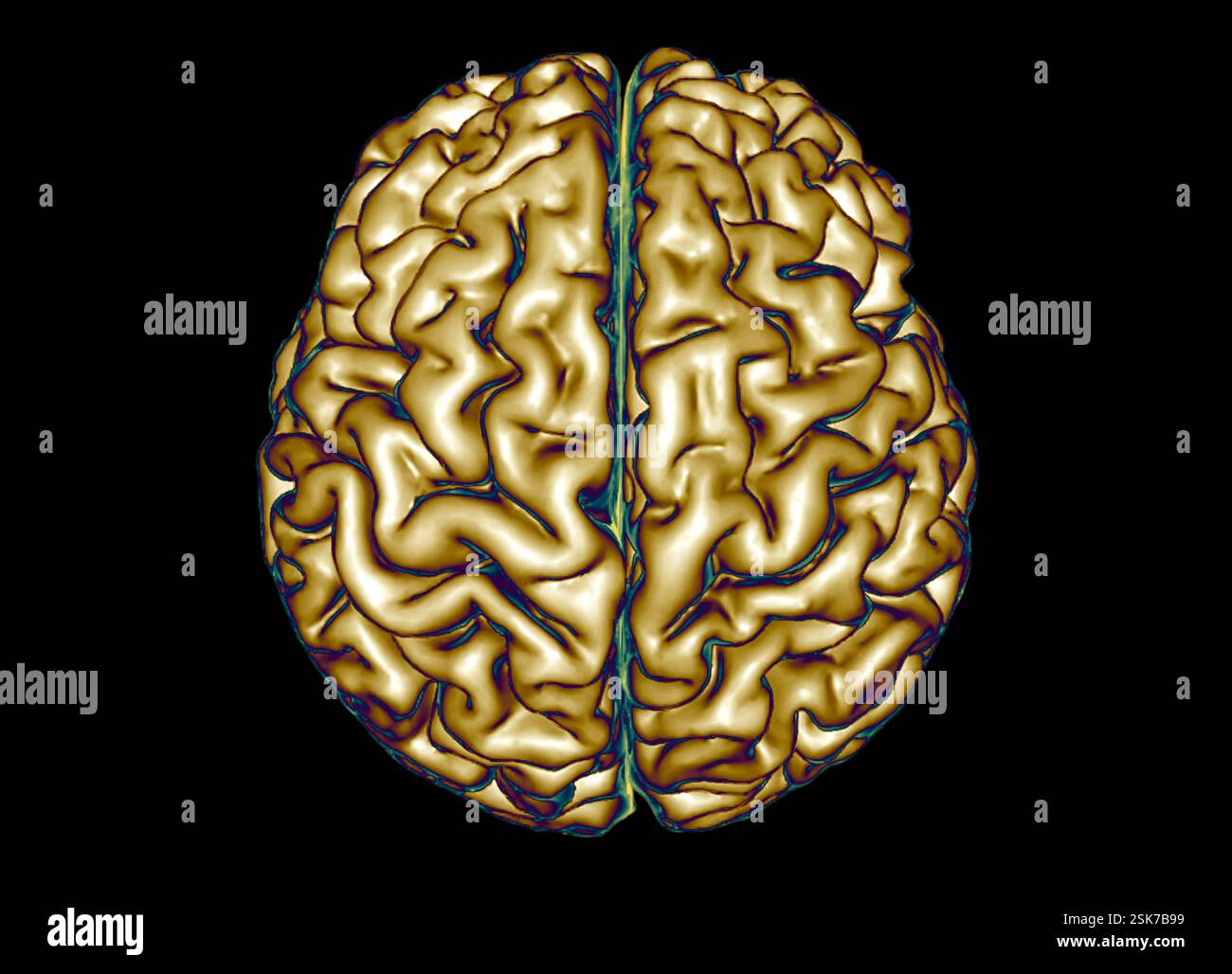 Human brain. Coloured three-dimensional (3D) Magnetic Resonance Imaging ...