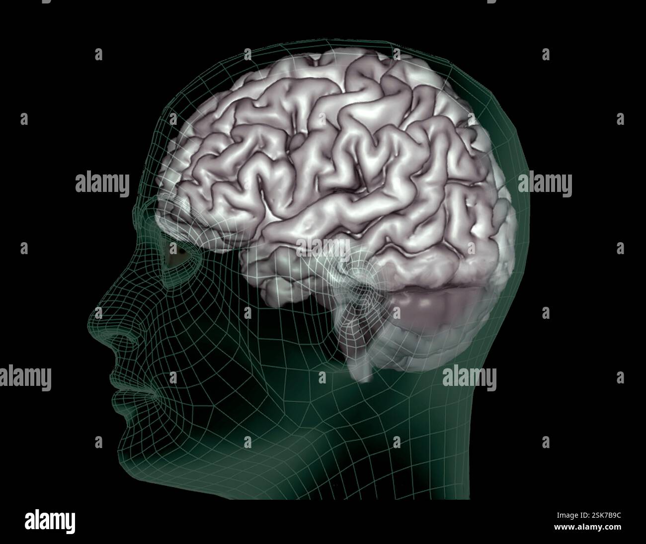 Human brain. Coloured composite image with 3D magnetic resonance imaging (MRI) scan of the ...