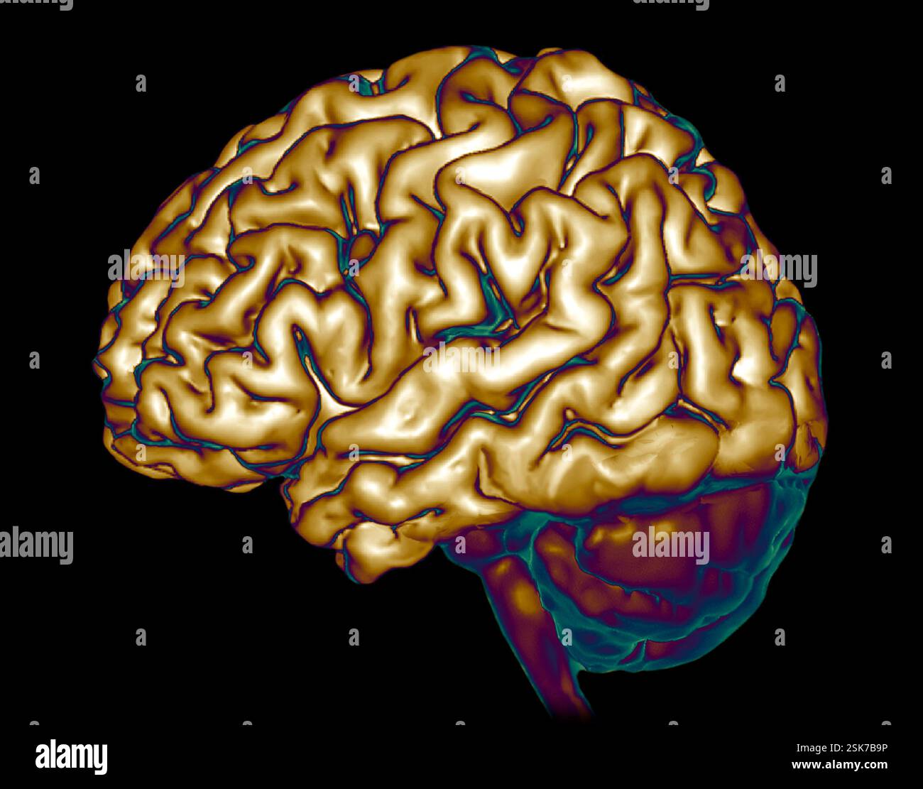 Human brain. Coloured three-dimensional (3D) Magnetic Resonance Imaging (MRI) scan in side view ...