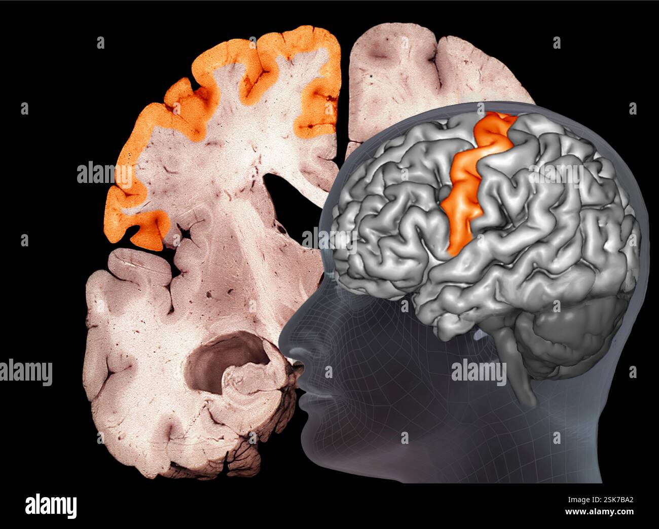 Human brain. Composite image showing the primary motor cortex of the ...