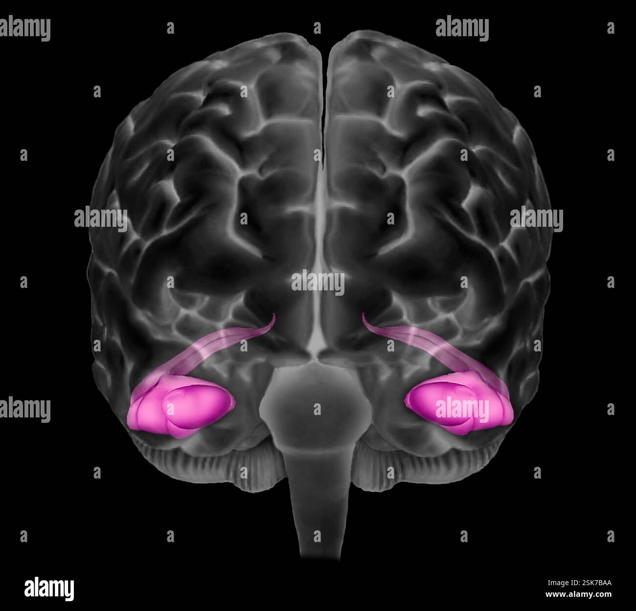 Human brain. Coloured three-dimensional (3D) Magnetic Resonance Imaging ...