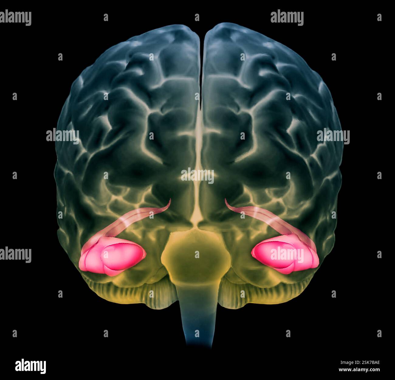 Human brain. Coloured three-dimensional (3D) Magnetic Resonance Imaging (MRI) scan in frontal ...