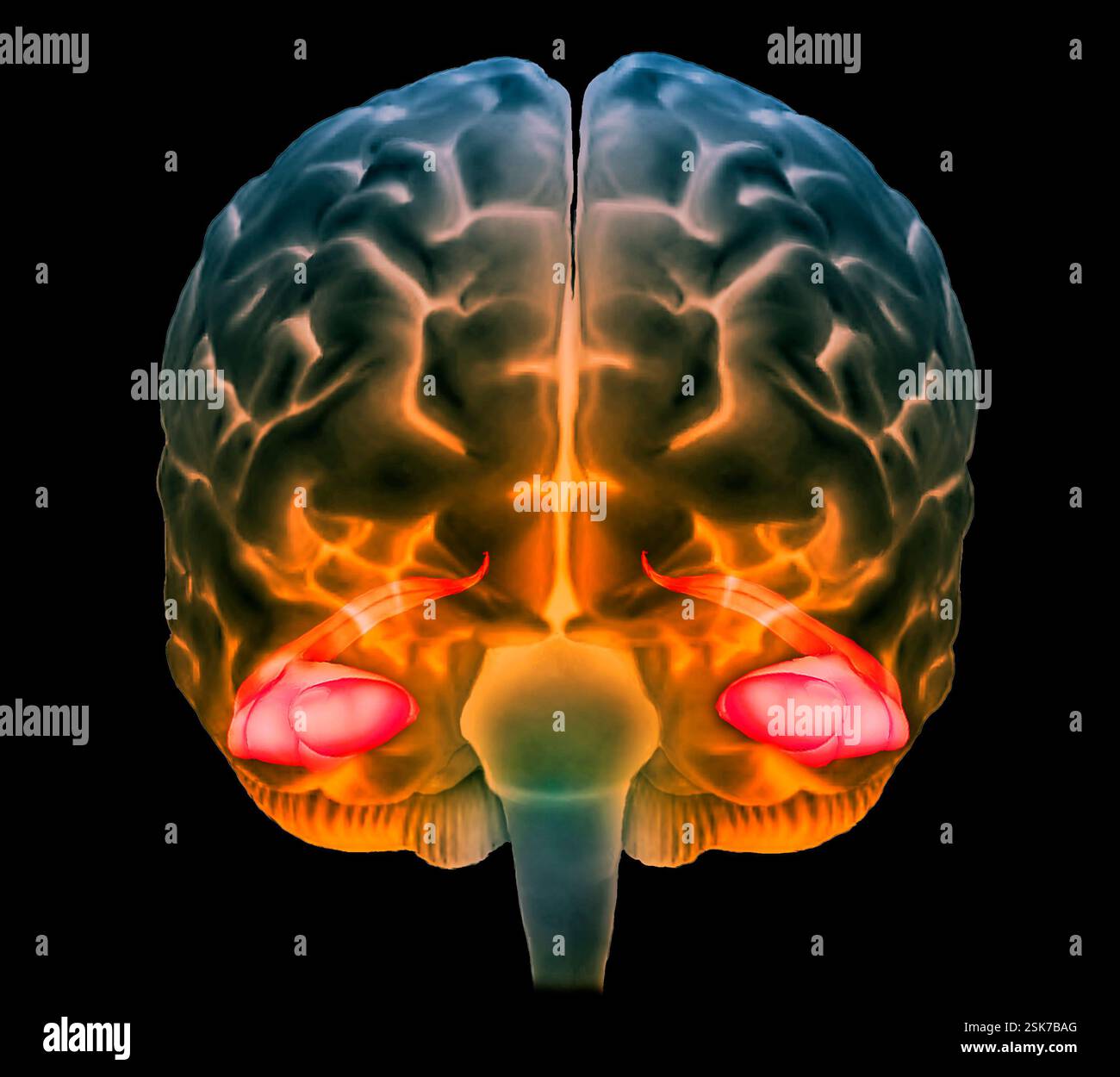Human brain. Coloured three-dimensional (3D) Magnetic Resonance Imaging (MRI) scan in frontal ...