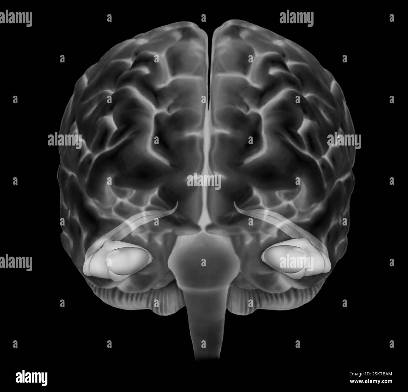 Human brain. Three-dimensional (3D) Magnetic Resonance Imaging (MRI ...