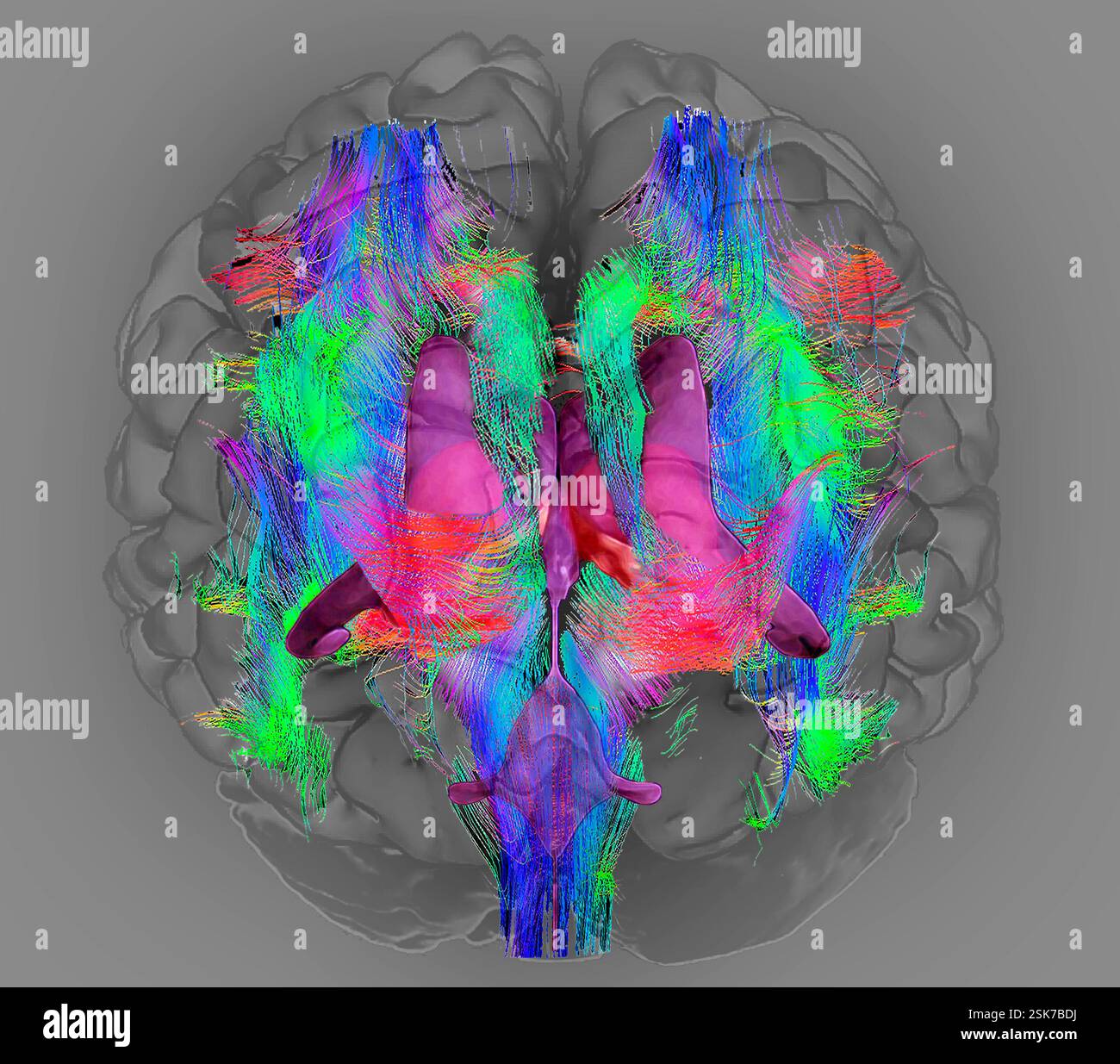 Brain fibres and structures. 3D diffusion tensor imaging (DTI) magnetic resonance imaging (MRI ...