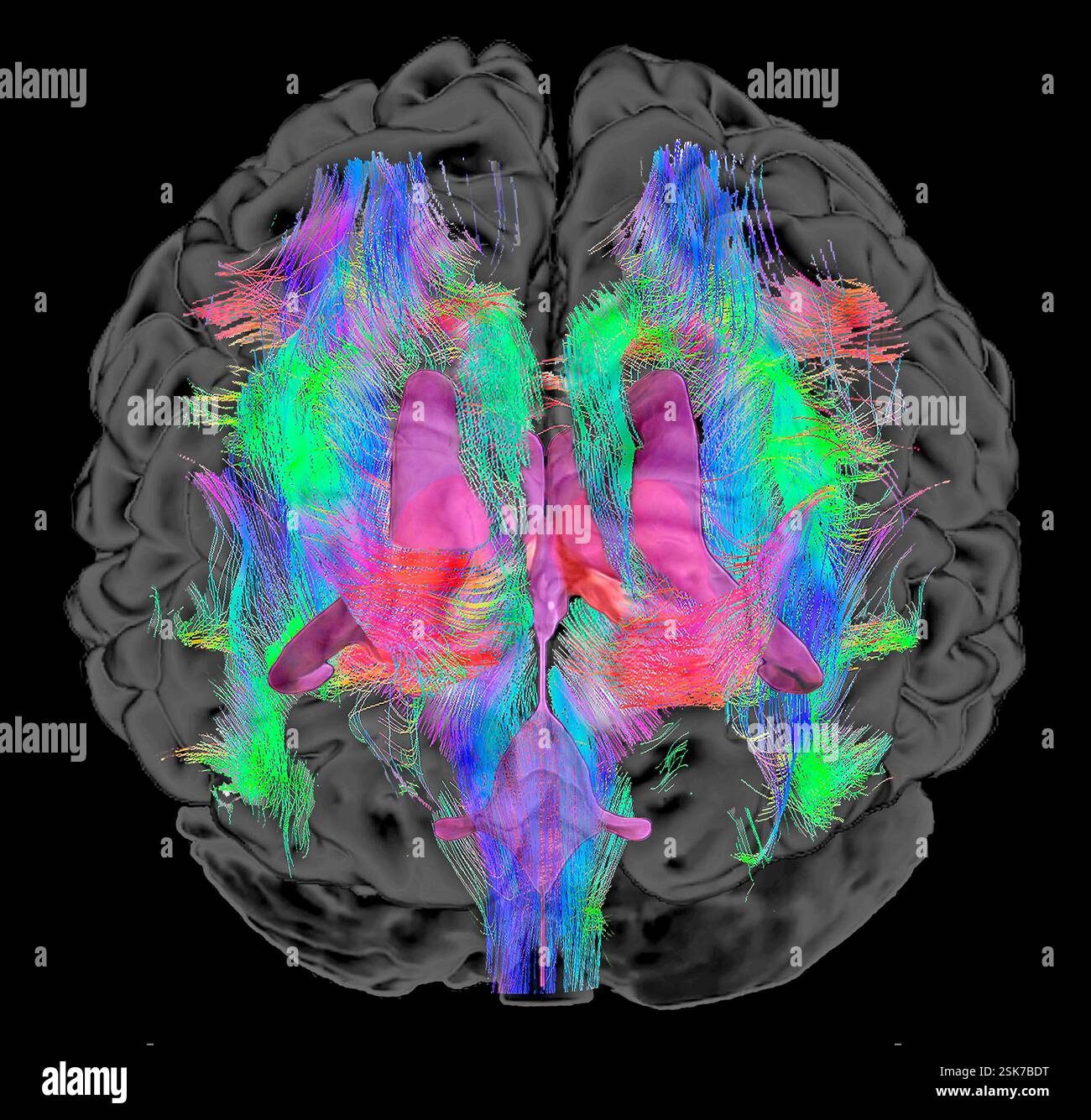 Brain fibres and structures. 3D diffusion tensor imaging (DTI) magnetic ...