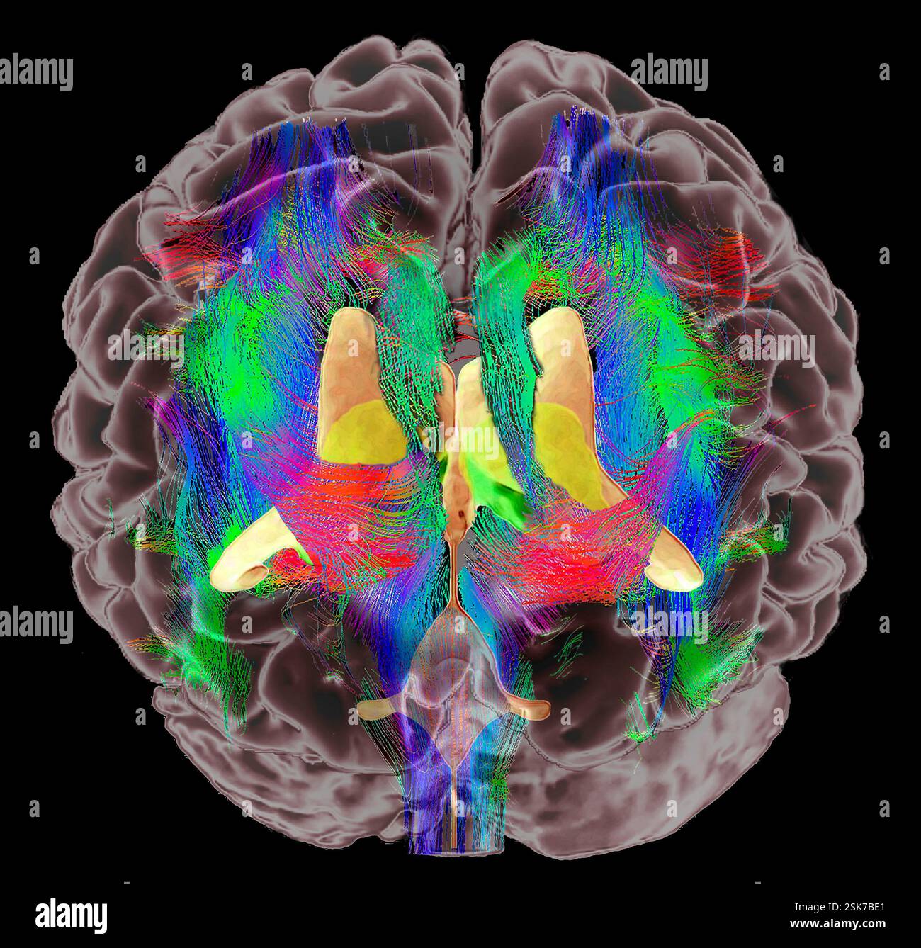 Brain fibres and structures. 3D diffusion tensor imaging (DTI) magnetic resonance imaging (MRI ...