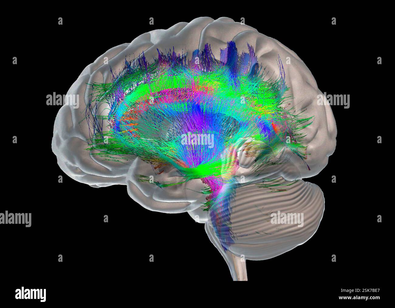 Brain fibres and structures. 3D diffusion tensor imaging (DTI) magnetic resonance imaging (MRI ...