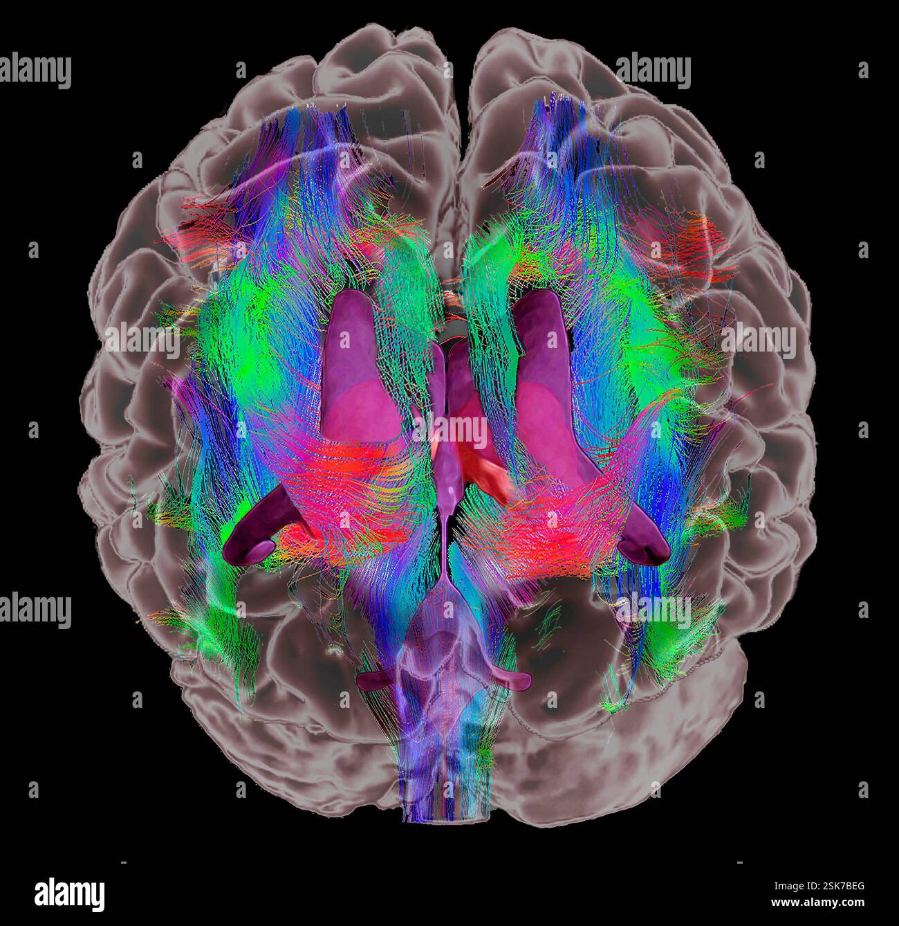 Brain fibres and structures. 3D diffusion tensor imaging (DTI) magnetic ...