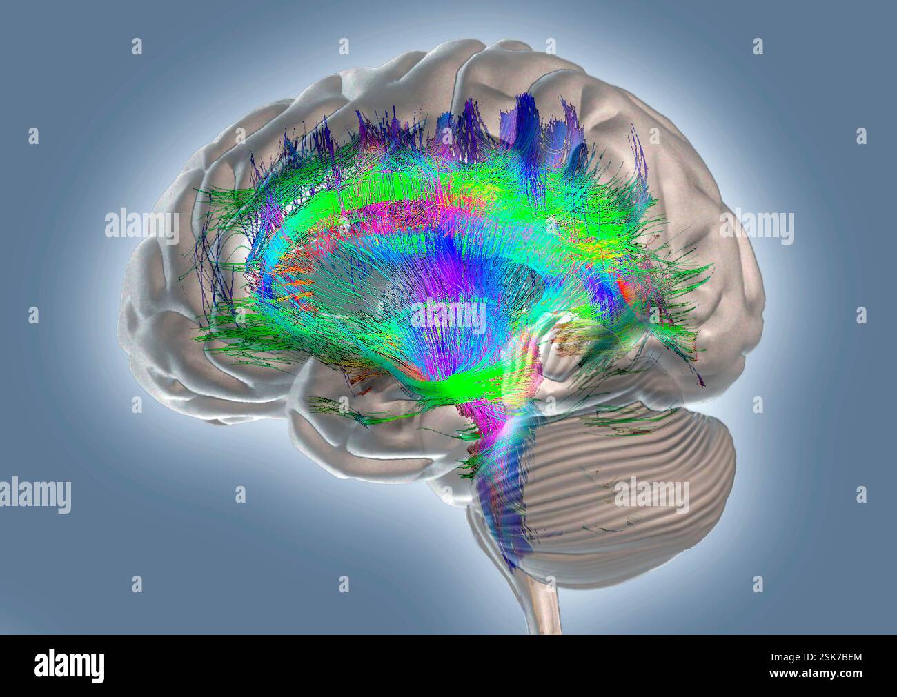 Brain fibres and structures. 3D diffusion tensor imaging (DTI) magnetic resonance imaging (MRI ...