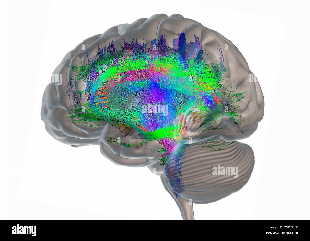 Brain fibres and structures. 3D diffusion tensor imaging (DTI) magnetic ...