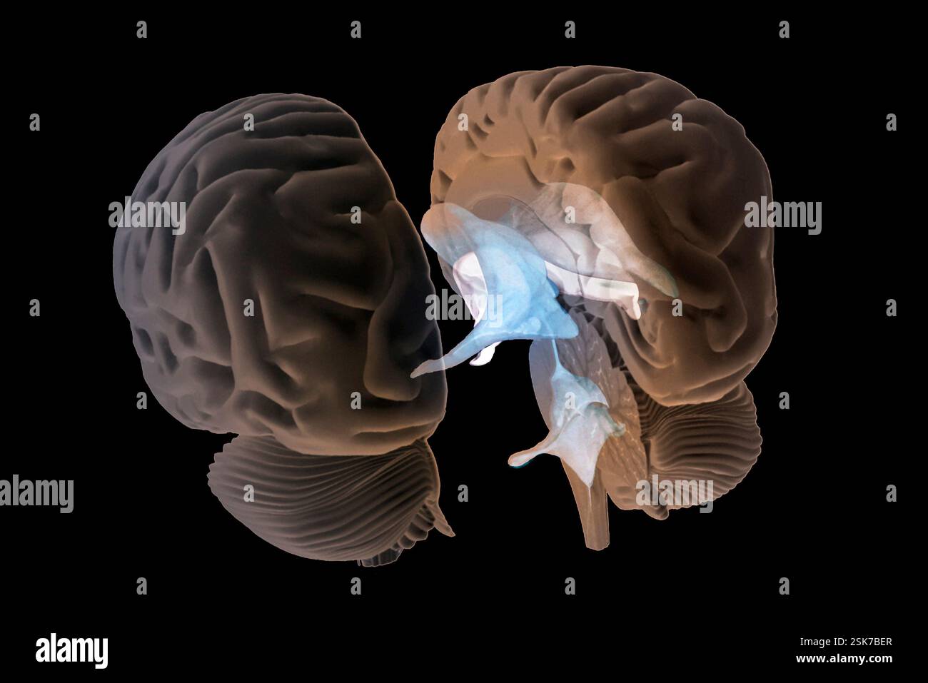Human brain. Coloured 3D magnetic resonance imaging (MRI) scan of a normal human brain, seen in ...