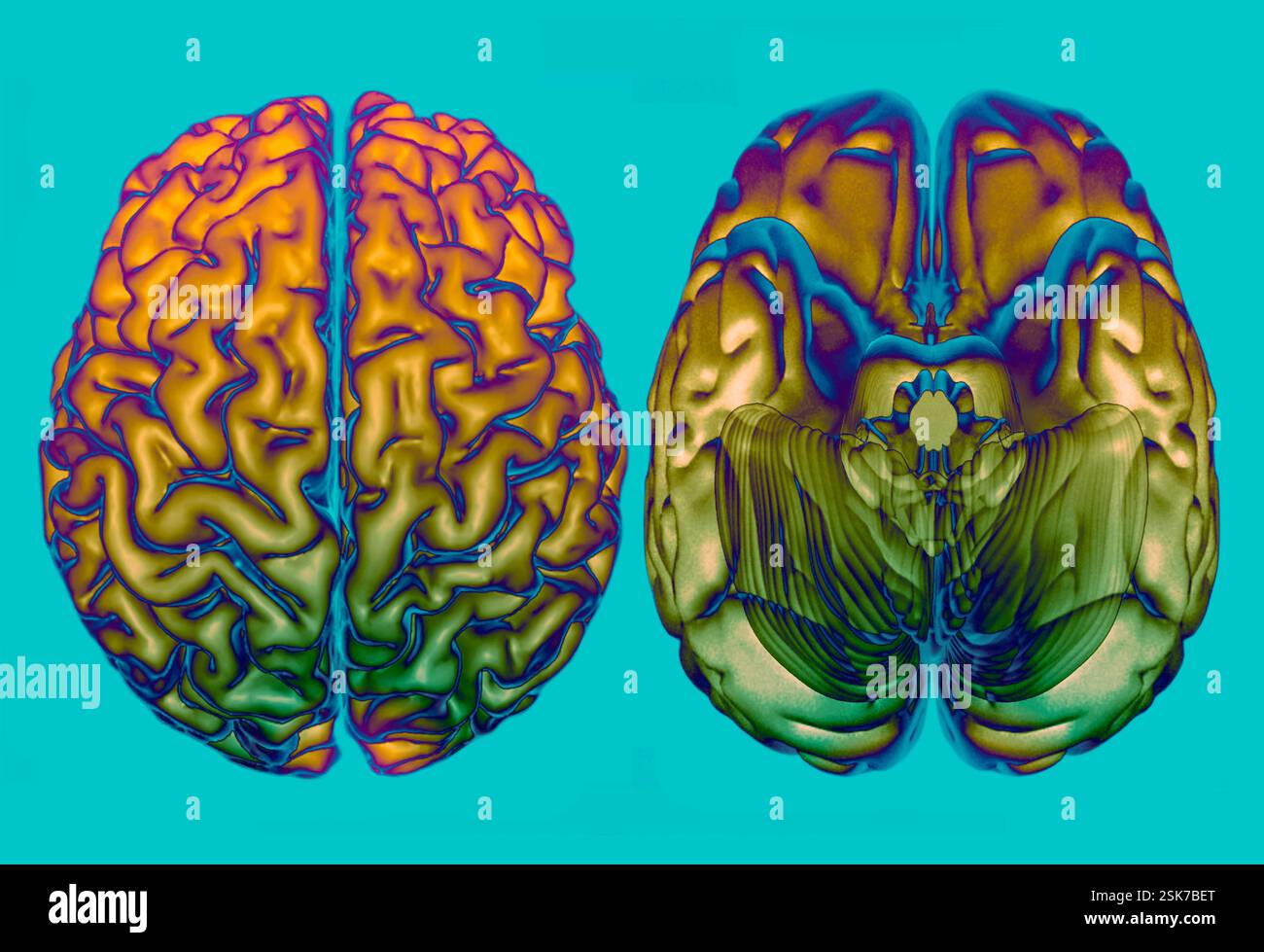 Human brain from above and below. Coloured 3D magnetic resonance ...