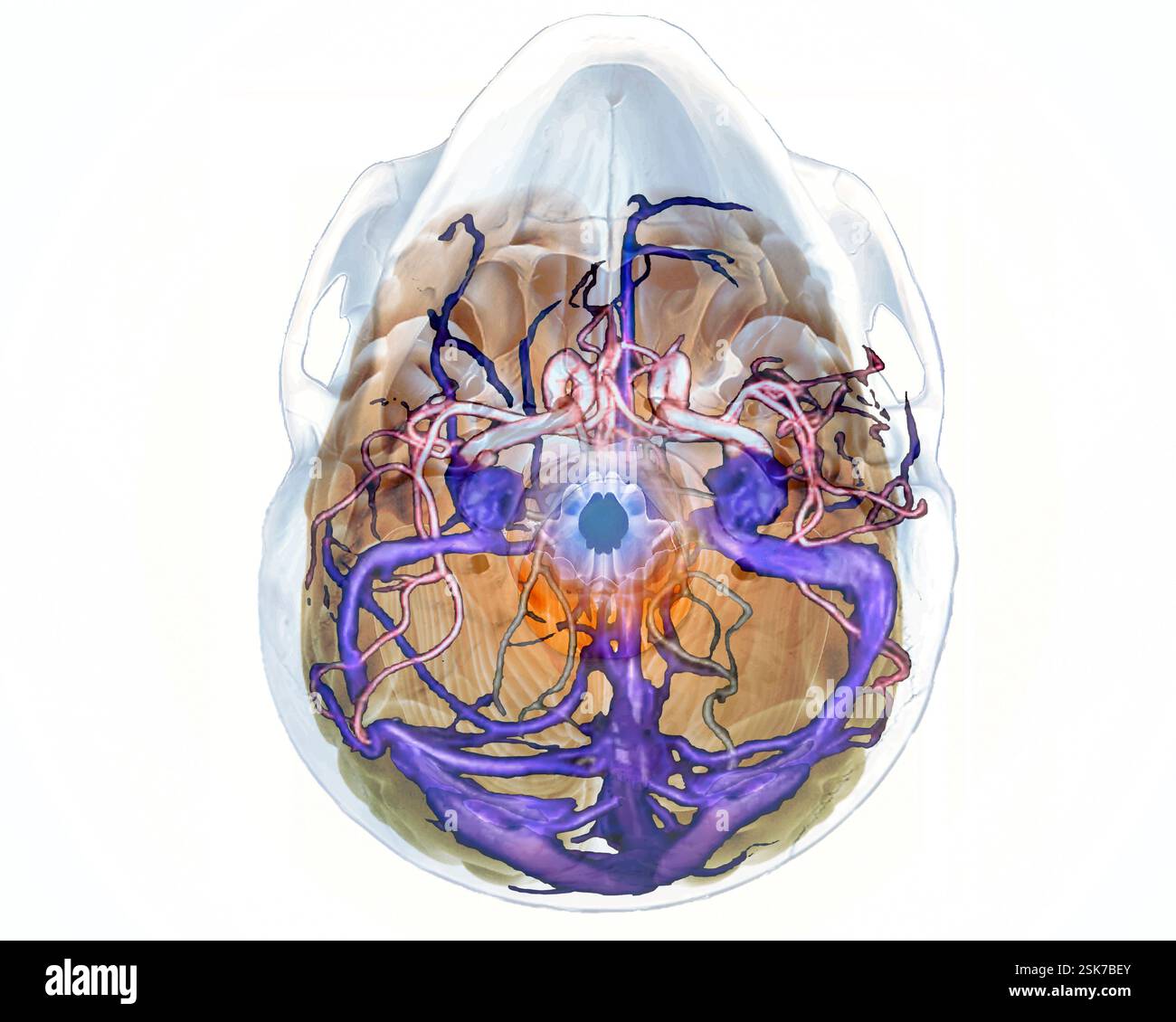 Brain arteries and veins. Coloured 3D magnetic resonance imaging (MRI) scan of the cerebral ...