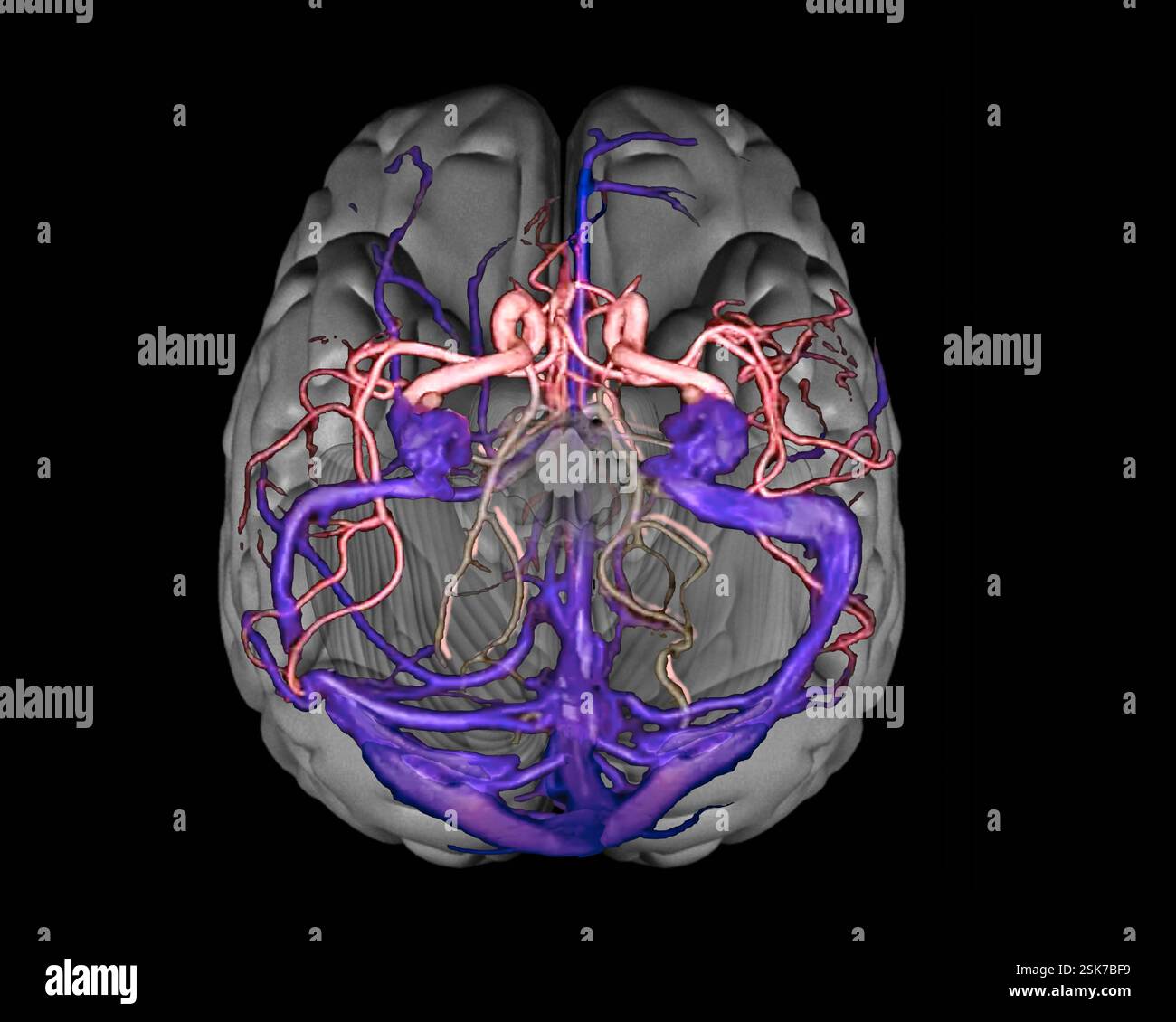 Brain arteries and veins. Coloured 3D magnetic resonance imaging (MRI ...