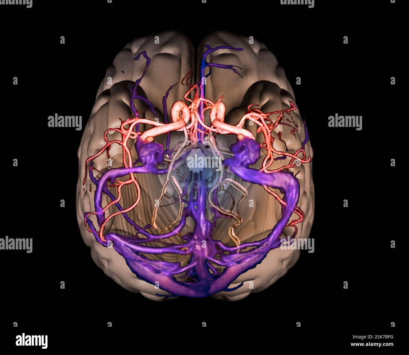 Brain arteries and veins. Coloured 3D magnetic resonance imaging (MRI) scan of the cerebral ...