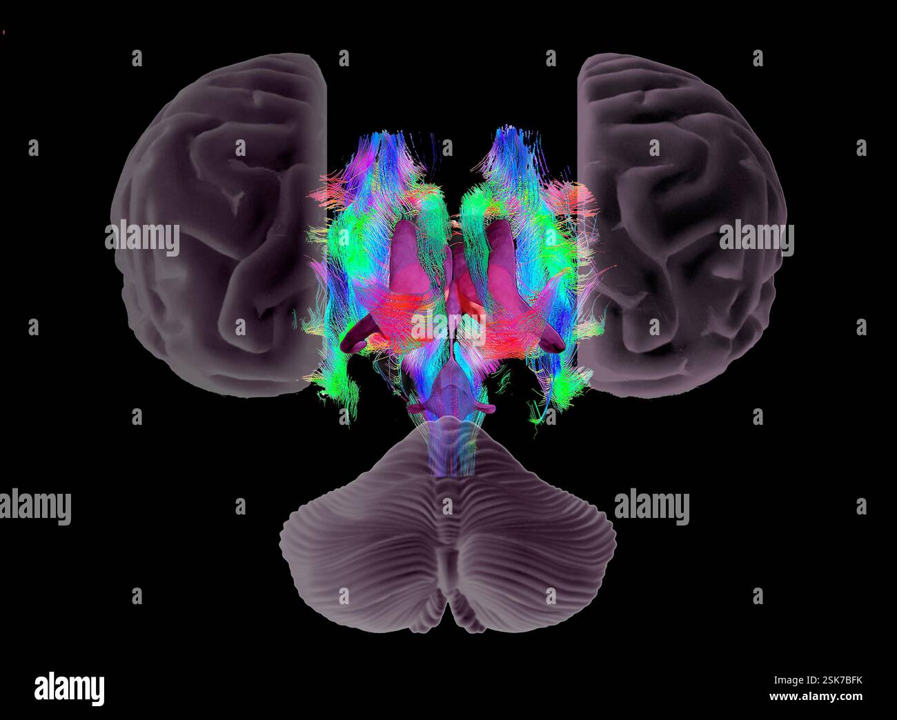 Brain fibres and structures. 3D diffusion tensor imaging (DTI) magnetic resonance imaging (MRI ...