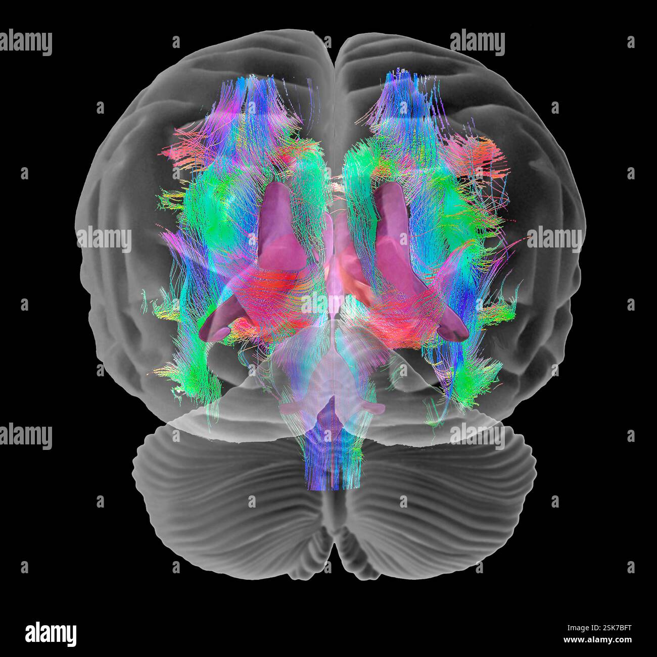 Brain fibres and structures. 3D diffusion tensor imaging (DTI) magnetic resonance imaging (MRI ...