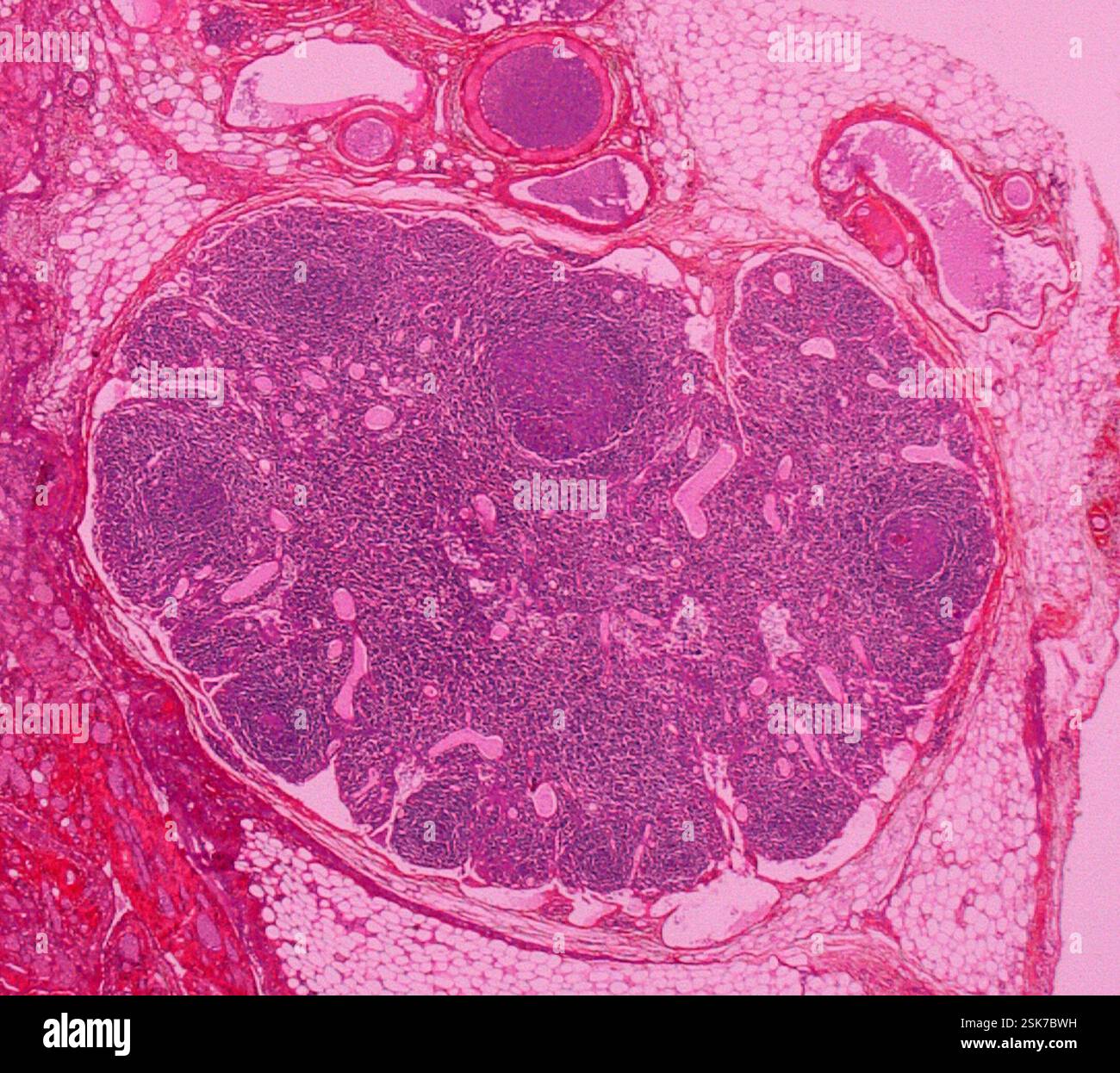 Normal lymph node. Light micrograph of a section through a healthy ...
