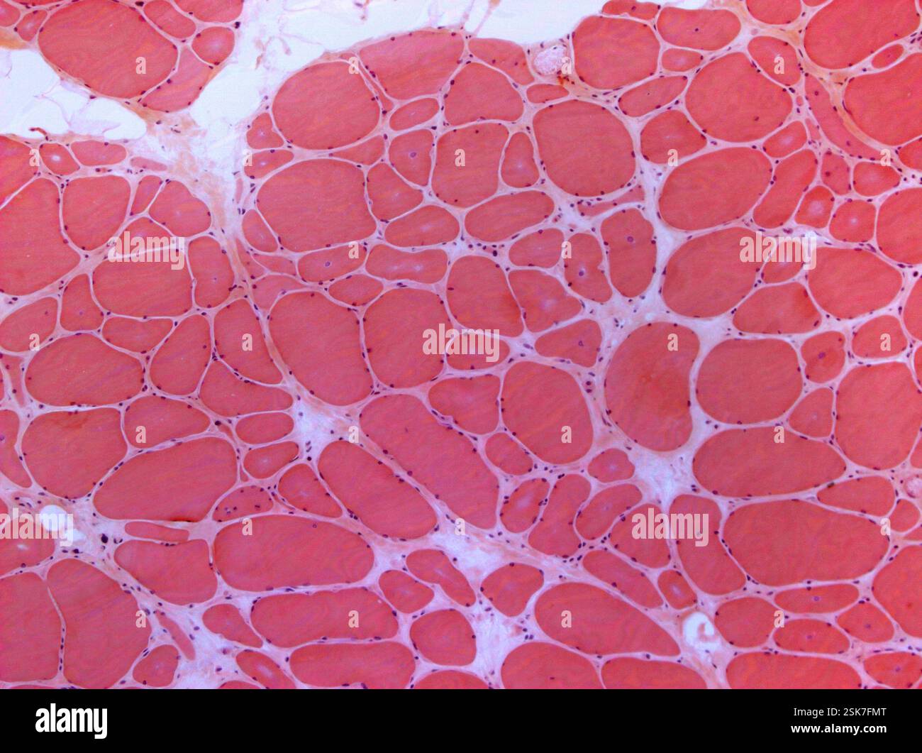 Light micrograph of a cross-section through skeletal muscle fibres ...