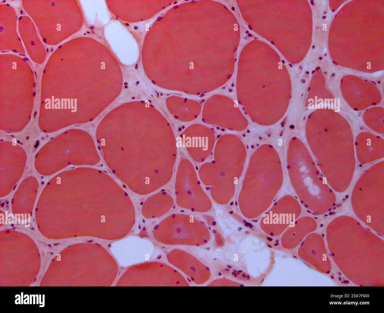 Light micrograph of a cross-section through skeletal muscle fibres ...