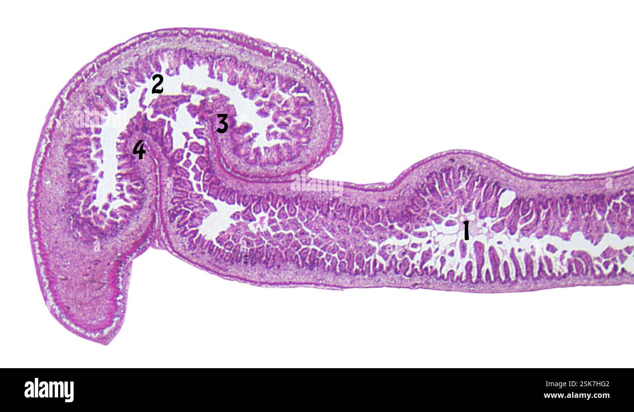 Labelled light micrograph of a healthy Ileocaecal valve (Bauhin's valve ...