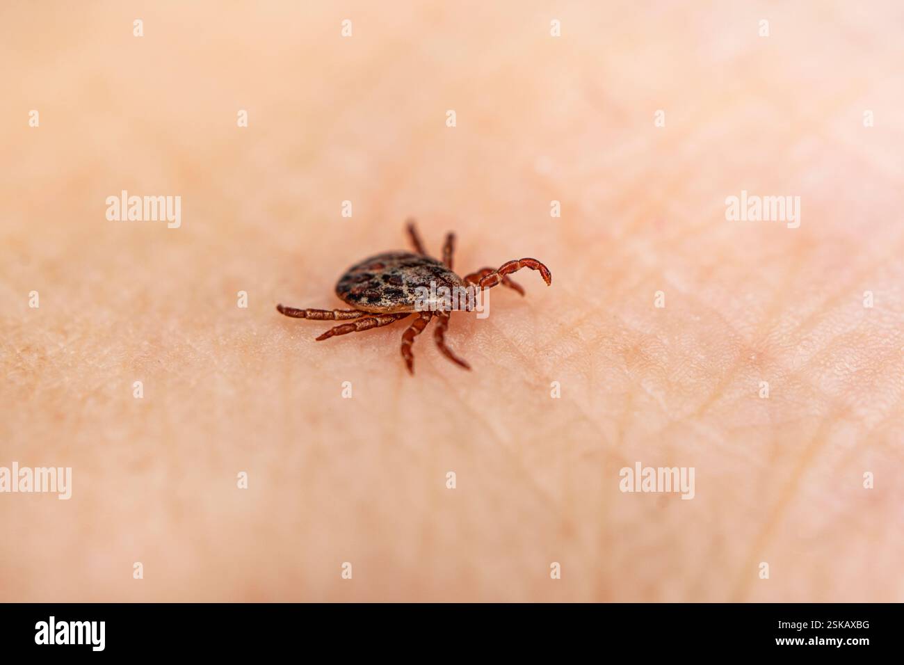 small brown insect mite crawls on human skin causing the risk of ...