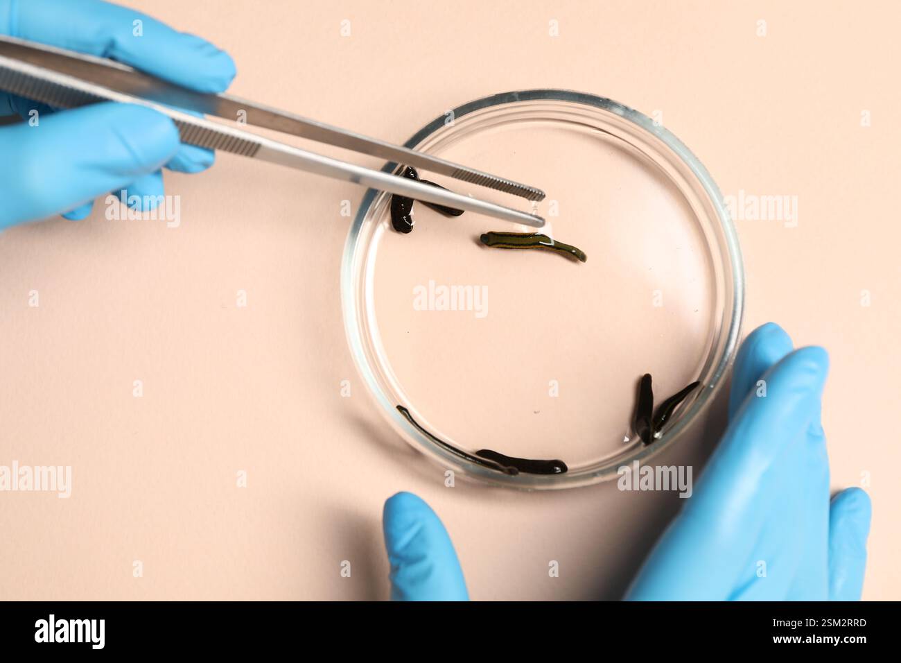 Doctor taking medicinal leech from Petri dish with tweezers on light ...