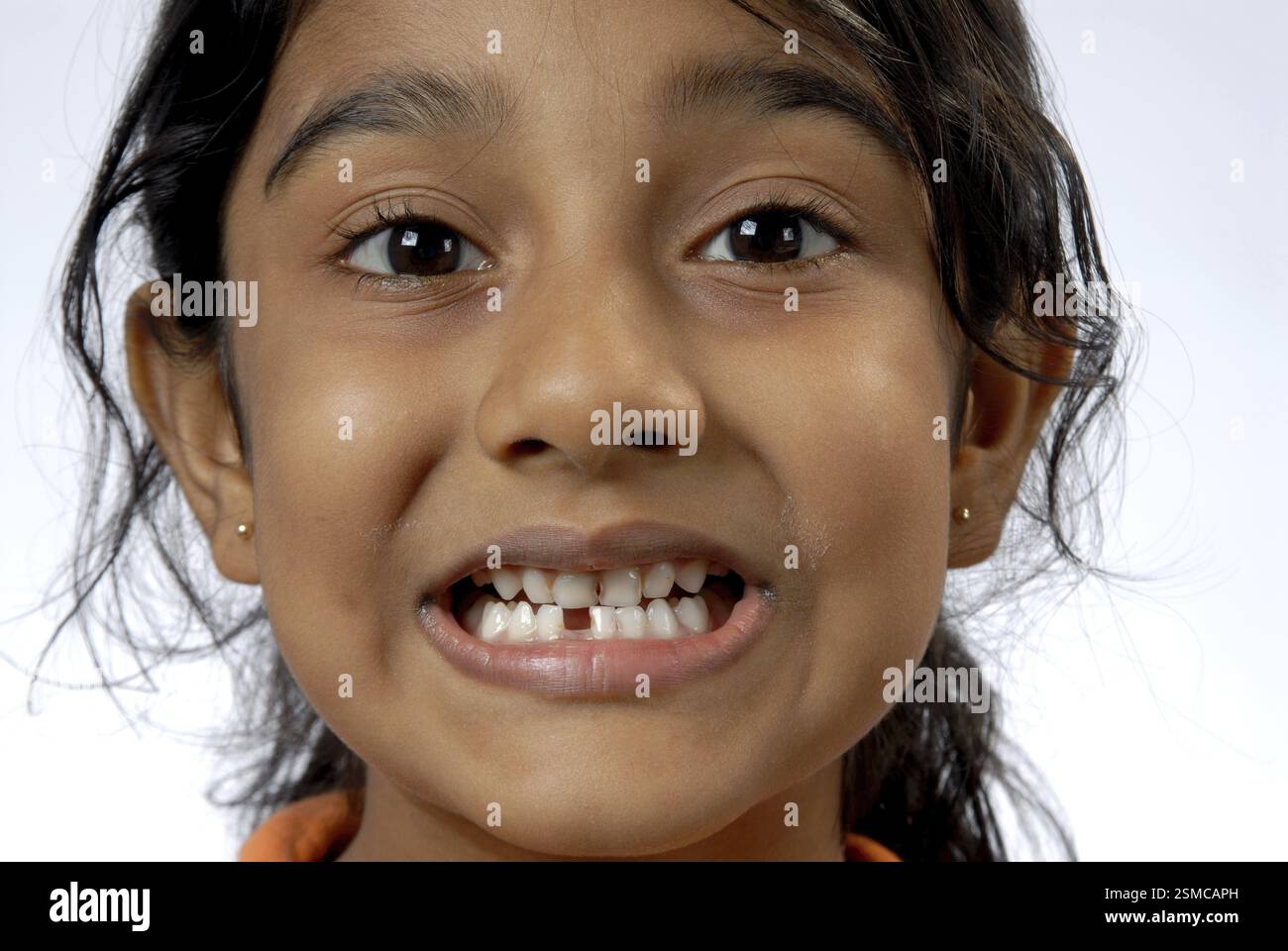 South Asian Indian girl showing broken teeth MR#152 Stock Photo - Alamy