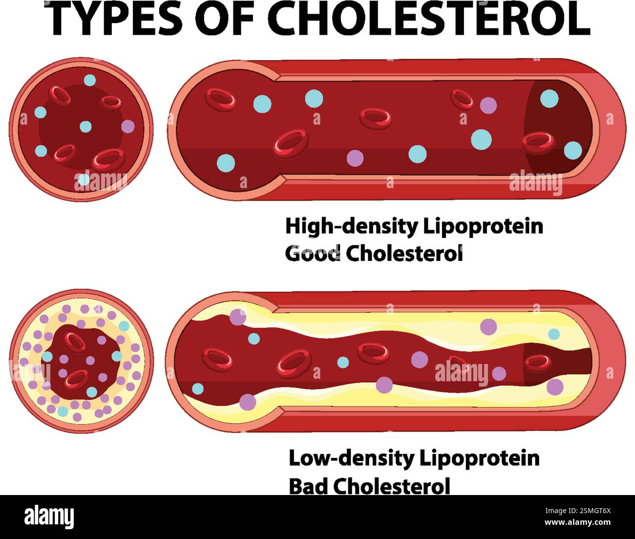 Blood cholesterol levels Stock Vector Images - Alamy