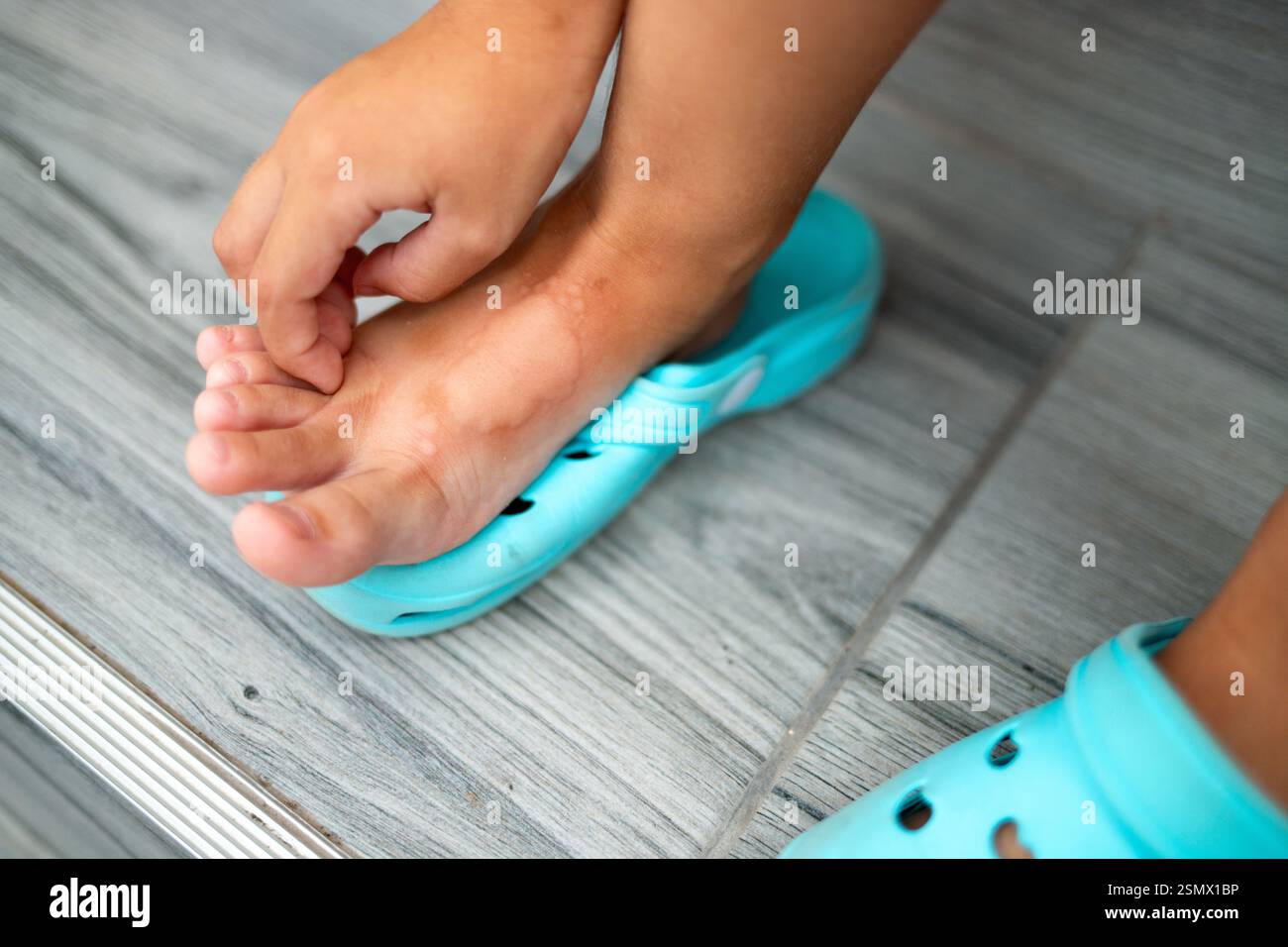 A child scratches their foot, showing redness and irritation from a ...