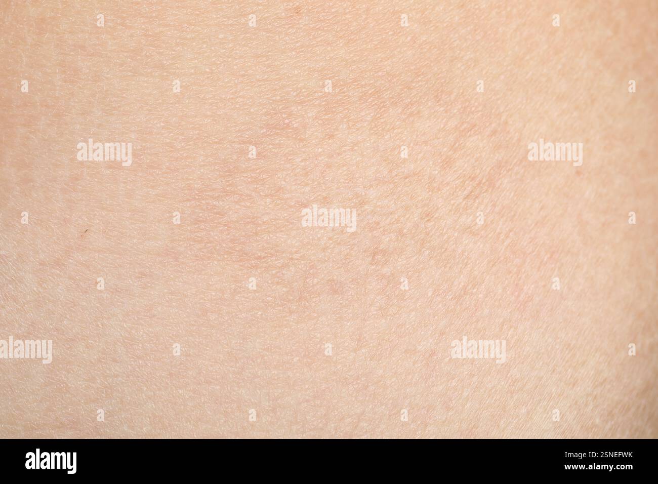Texture of skin with scar as background, closeup Stock Photo - Alamy