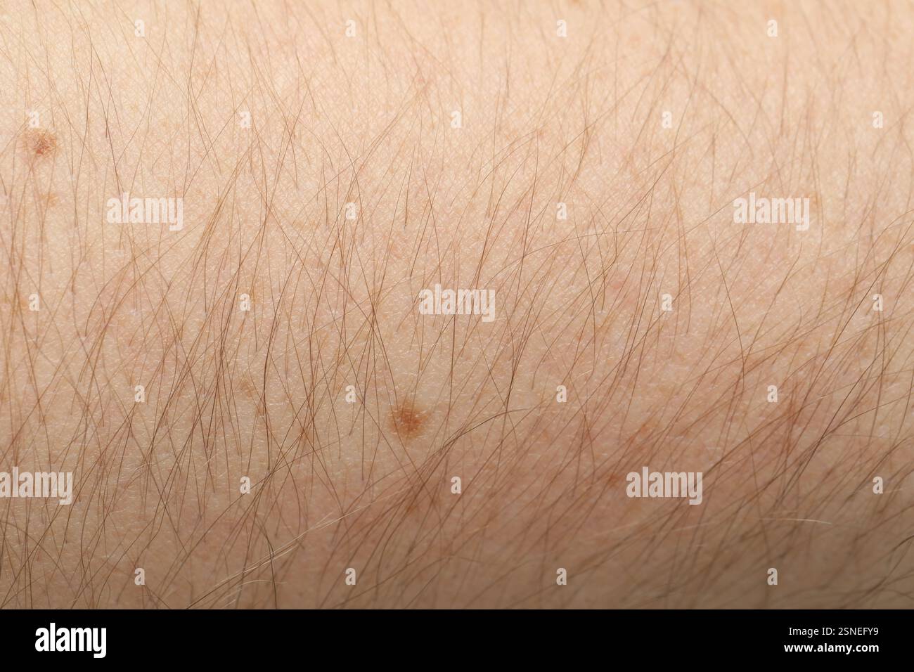 Texture of normal skin as background, closeup Stock Photo - Alamy