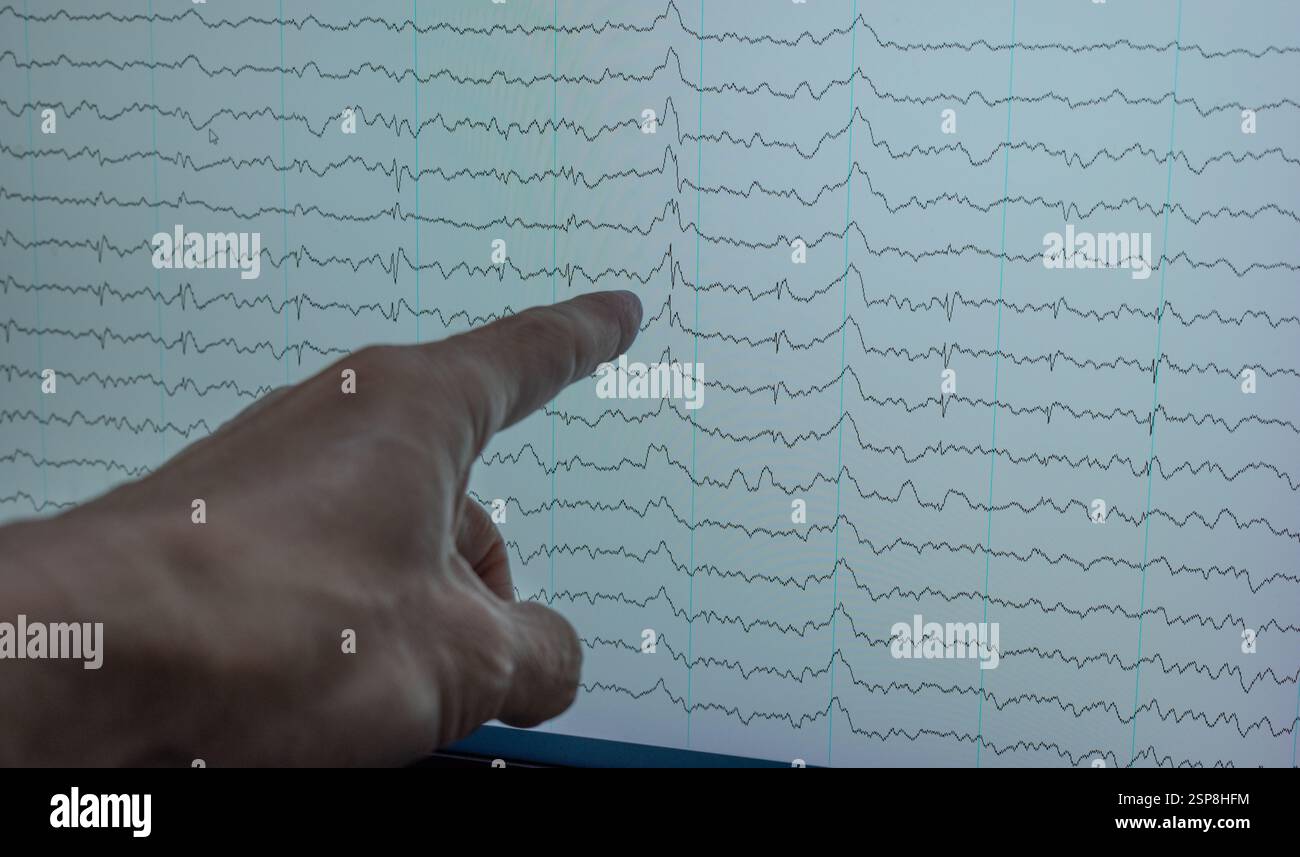 A Hand Pointing At Eeg Graph On Screen Analyzing Brainwave Patterns