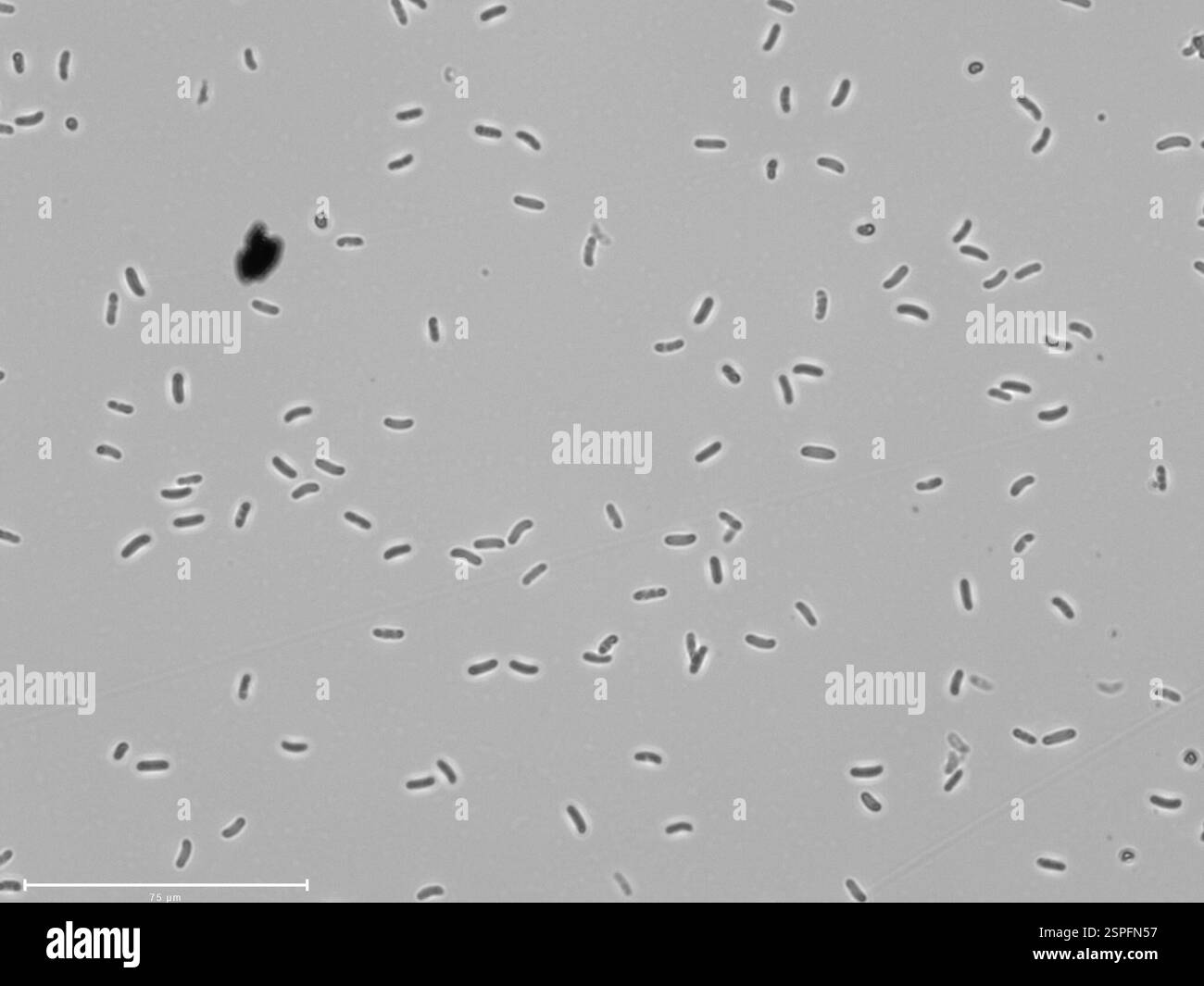 Red Tree Brain Fungus (Peniophora rufa), Fungi, Alewife Brook ...