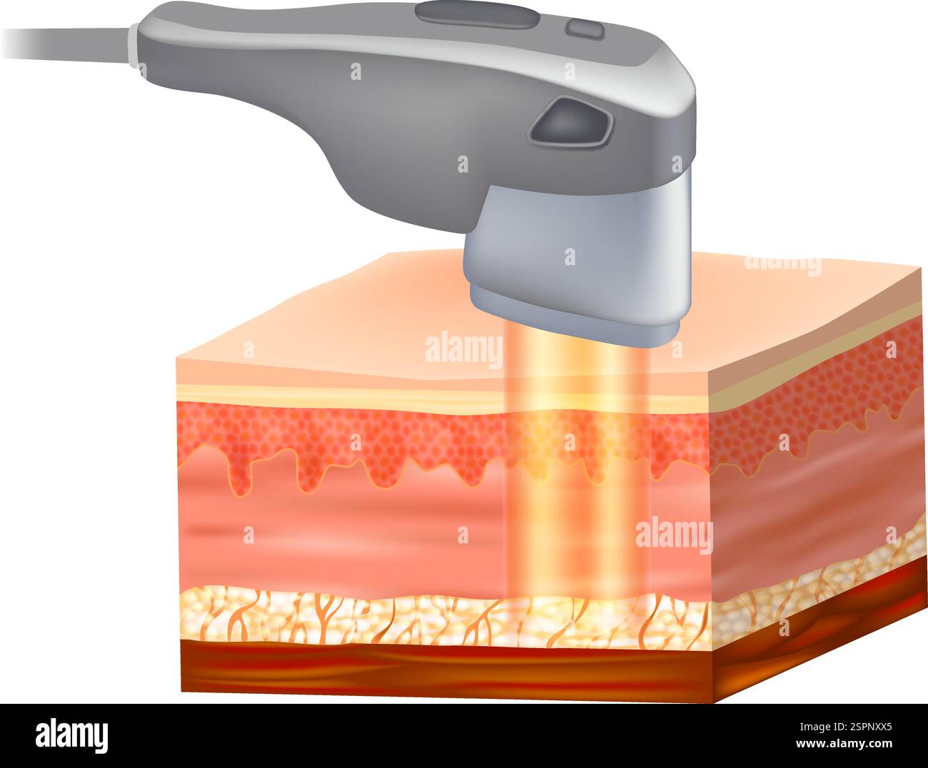 Hifu Cut Out Stock Images & Pictures - Alamy