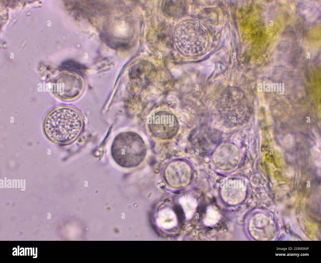 (Entyloma bellidis), Fungi, 35390 Gießen, Deutschland, ex bellis ...