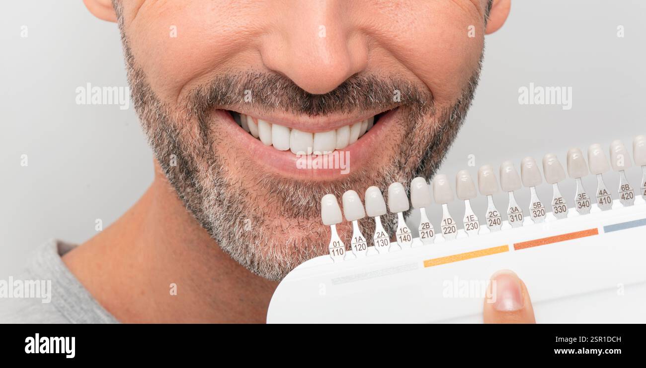 Man holding a teeth whitening shade chart. Perfect smile, teeth ...