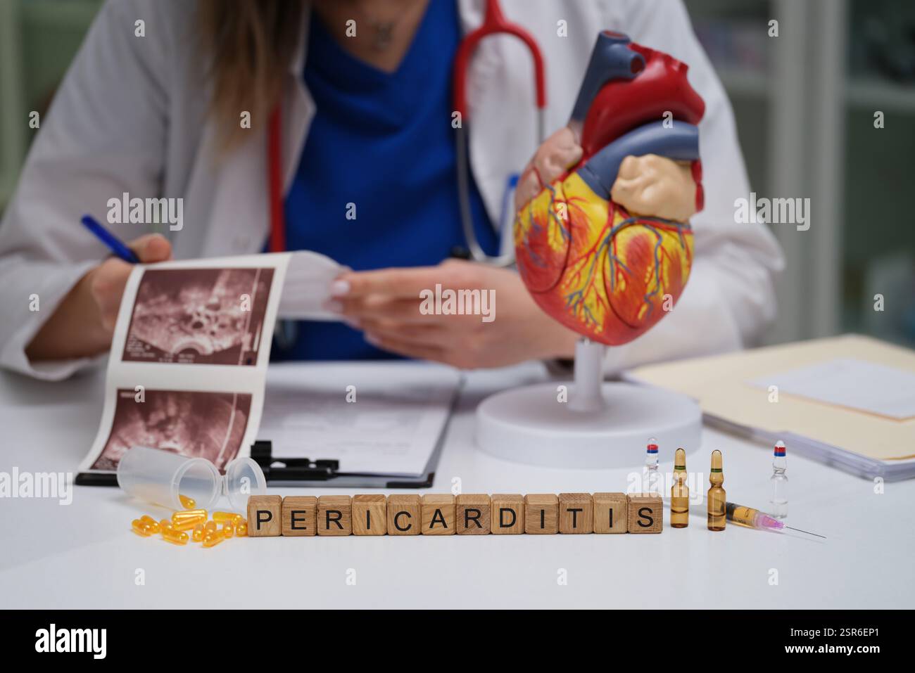 A comprehensive professional overview of pericarditis, featuring ...