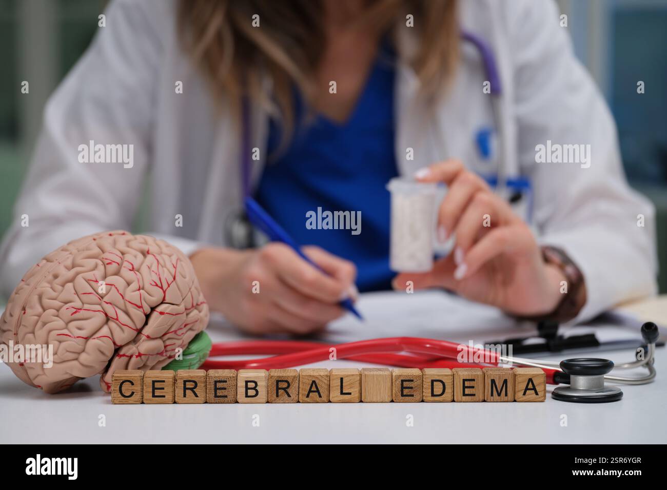 Were exploring cerebral edema complexities clinically, collaborating ...