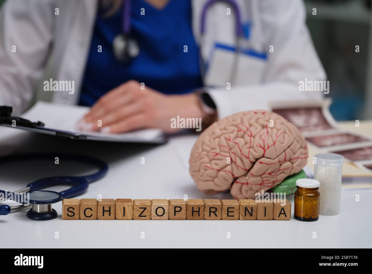 Delve into the intricate complexities of schizophrenia through detailed ...