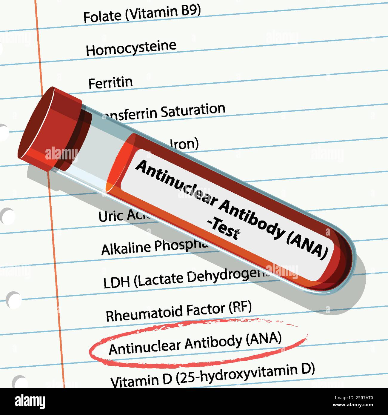 Illustration of ANA test tube on medical list Stock Vector Image & Art ...