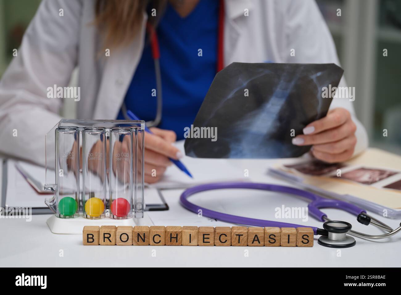 A medical professional is analyzing an Xray related to bronchiectasis ...