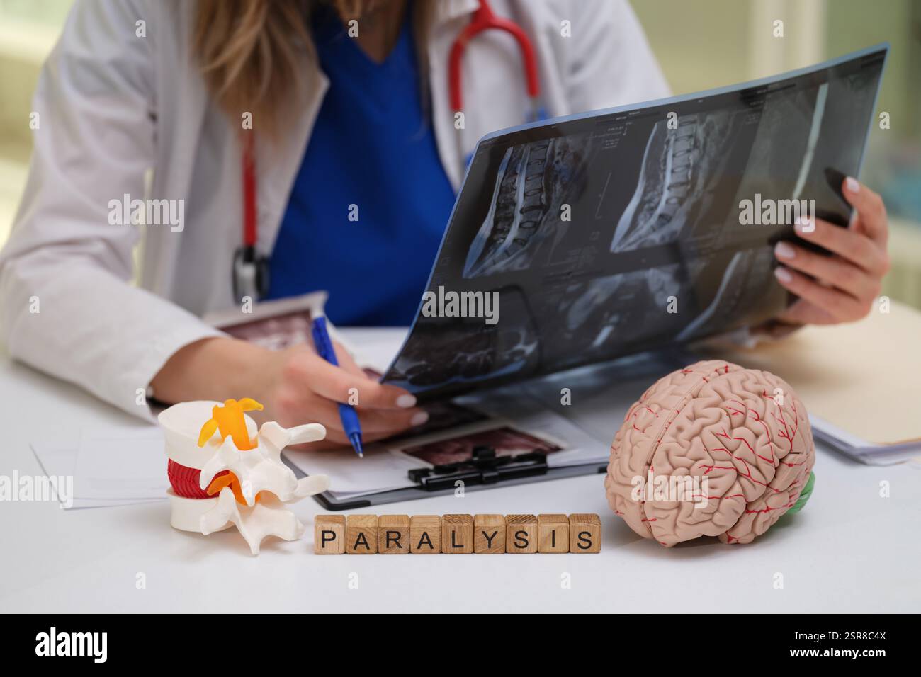 The Doctor is Analyzing Xray Images for Accurate Paralysis Diagnosis ...