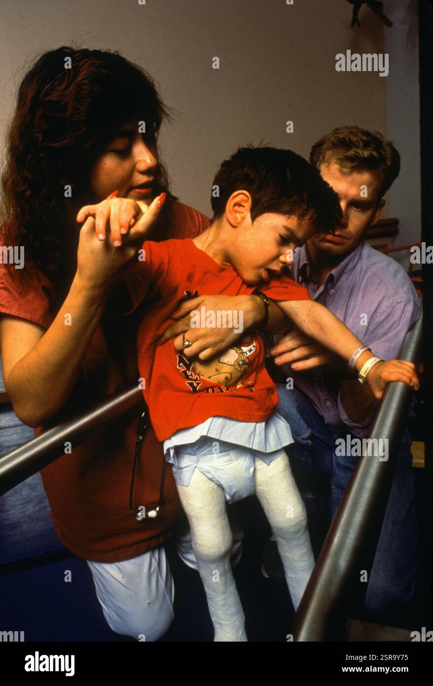 Child born pre-maturely in leg casts to help him walk. Physical therapy ...