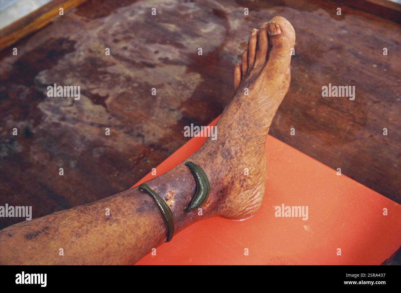 Indian leech hi-res stock photography and images - Alamy