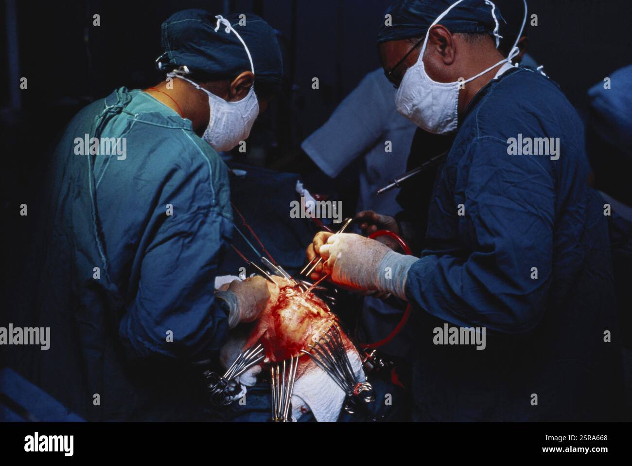 Open heart surgery, India, Asia Stock Photo - Alamy