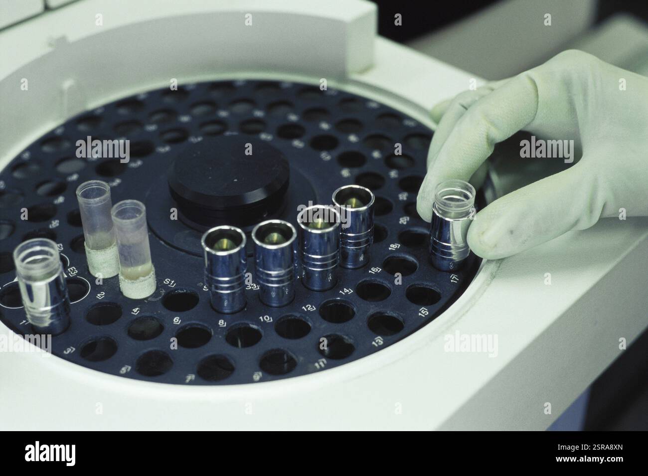 Hospital, pathology department, India, Asia Stock Photo - Alamy