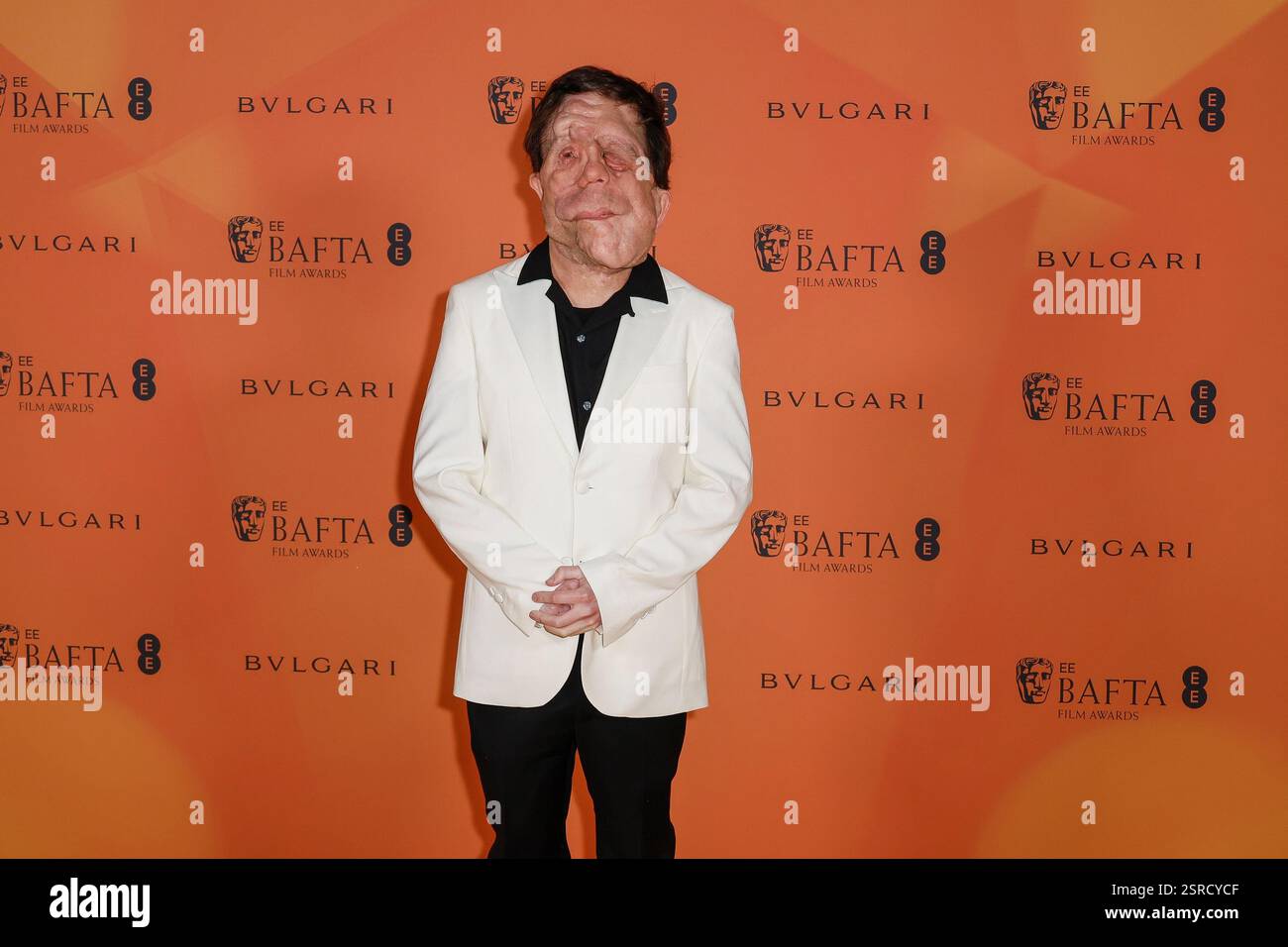 Adam Pearson poses for photographers upon arrival at the BAFTA Nominees ...